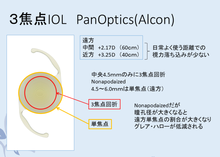 3焦点眼内レンズ PanOpticsⓇについて｜医療法人 森井眼科クリニック｜神戸市東灘区御影駅前